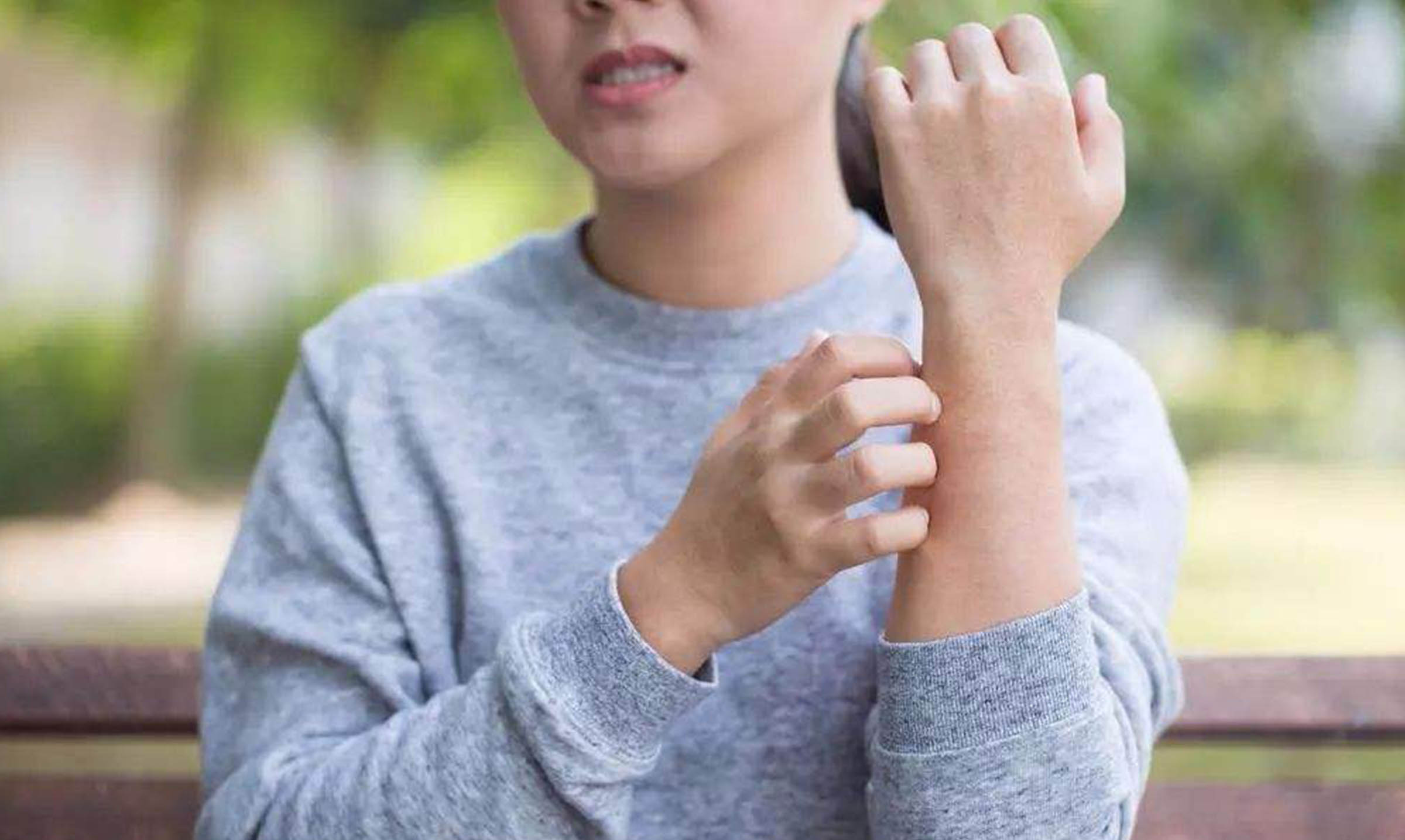 Huidklachten – CMDC